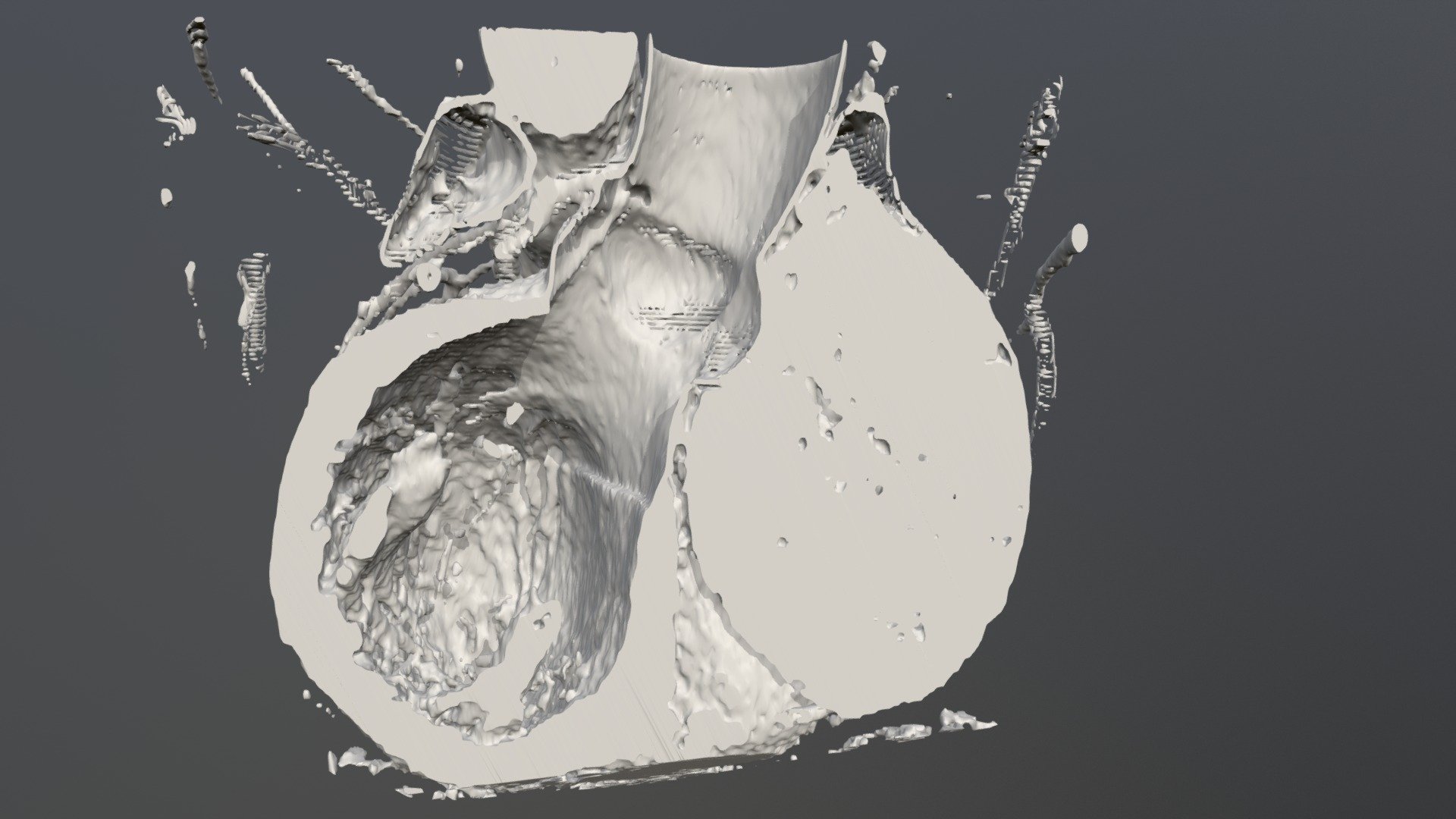 Heart4split Final - Download Free 3D model by trivedi.jaimin [a461146 ...