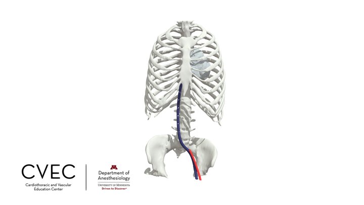 Ecmo 3D models - Sketchfab