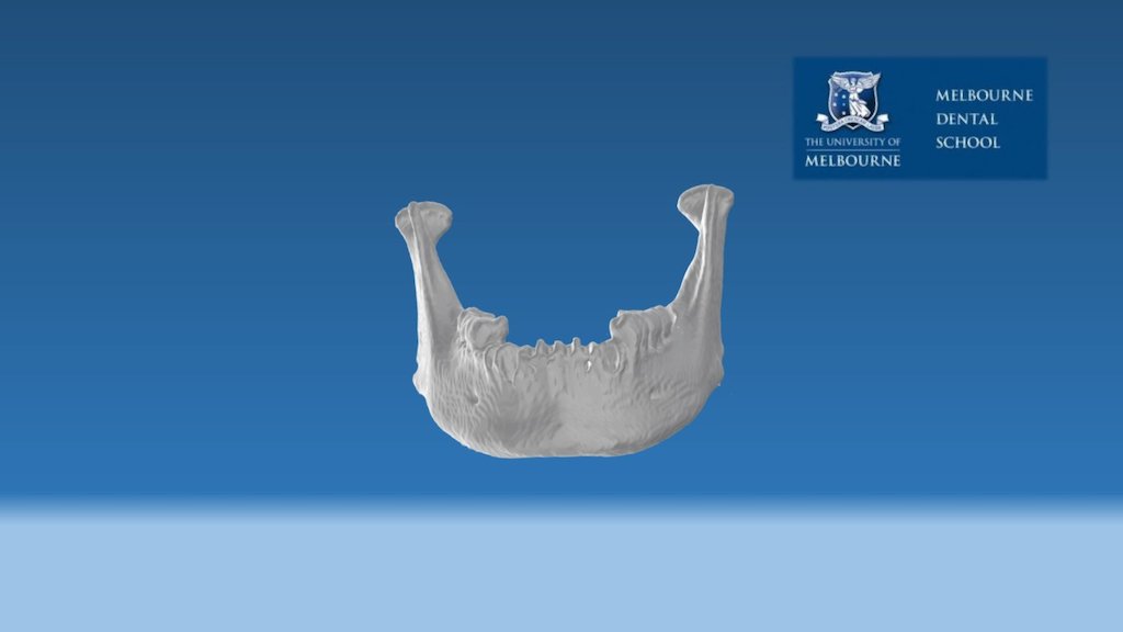 Skull 2868 mandible - 3D model by Melbourne Dental School ...