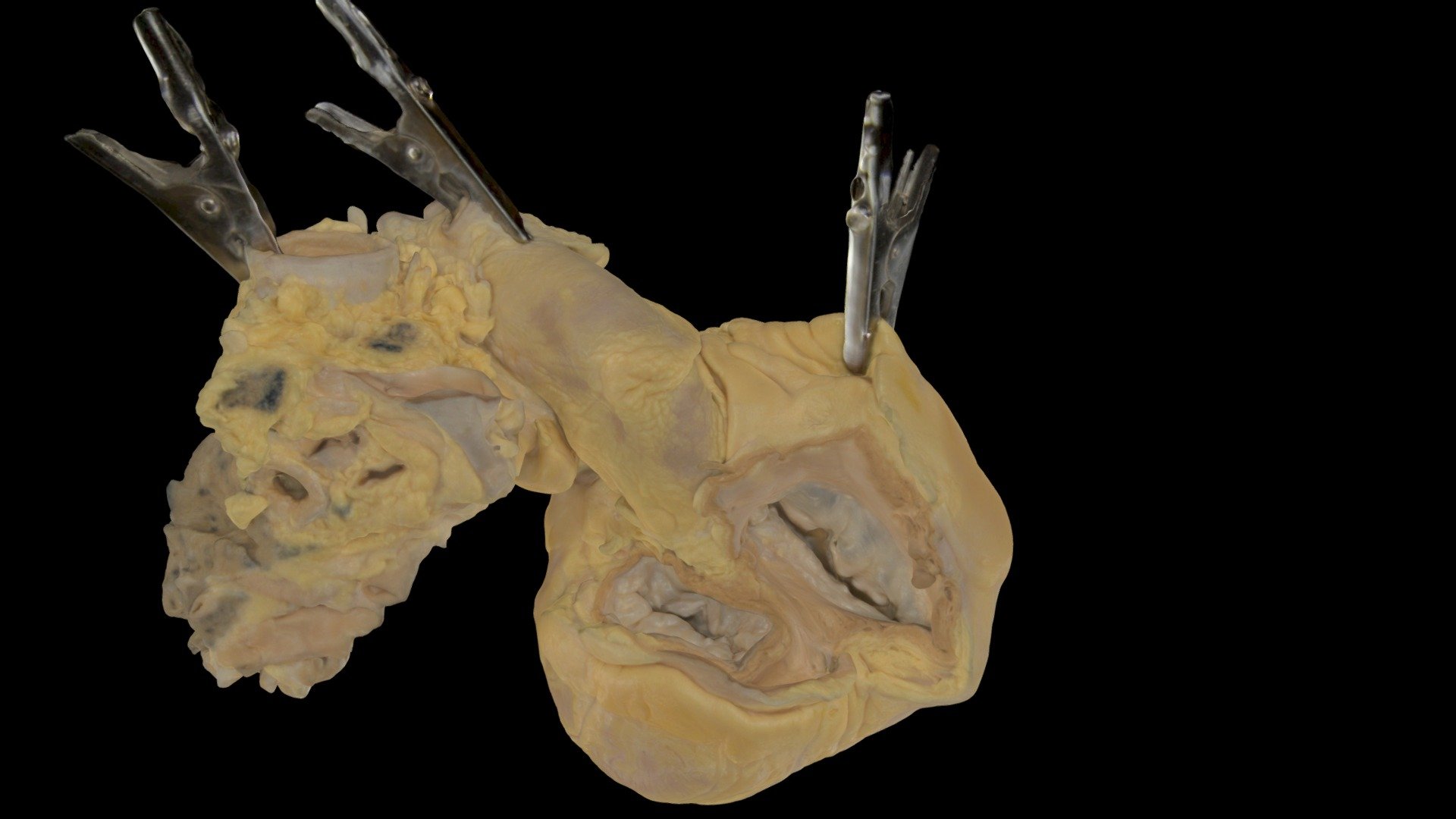 Perfusion Fixed Human Heart Valve View #0290 - Download Free 3D model ...