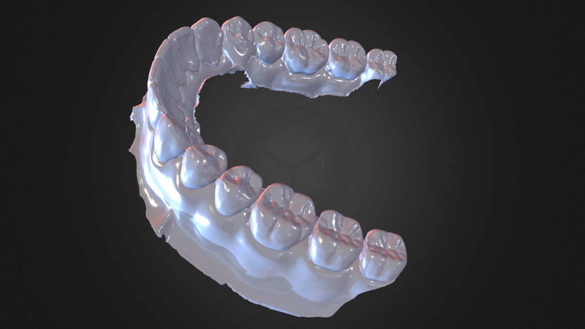 Mandibular Cast - 3D model by mdentalmargeaux [a5476d7] - Sketchfab