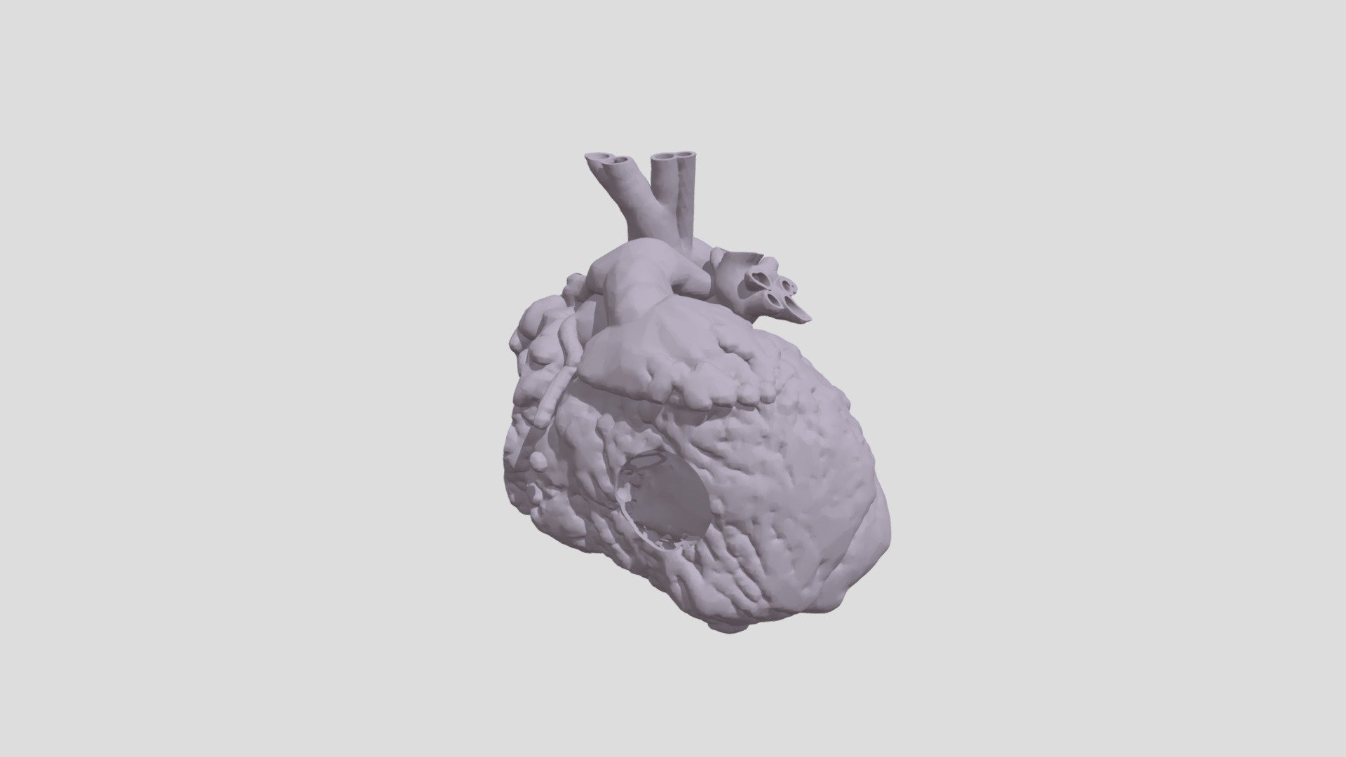 d-TGA with dual VSDs (H0311) - 3D model by NCH Advanced Projects ...