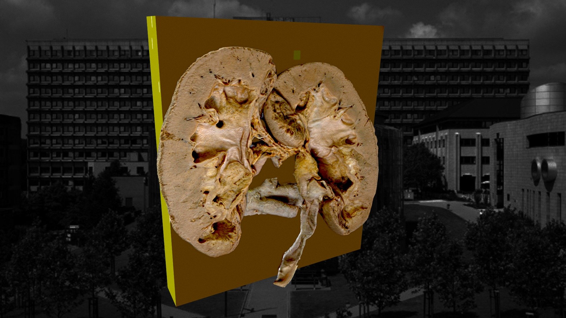 Rein - 3D model by Prof. Serge VAN SINT JAN - Univ. Libre Bruxelles ...