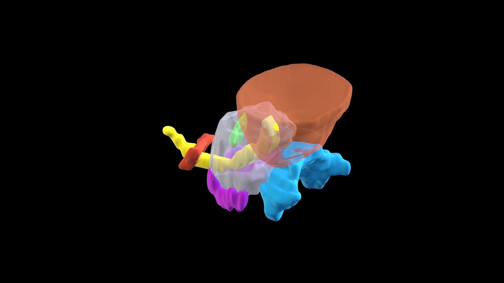 Prostate Tumor - 3D model by Cirurgic3D (@neorenal) [a5b233f] - Sketchfab