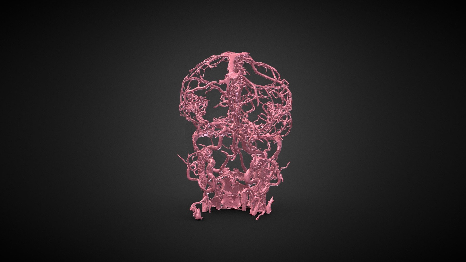 NSBS - ACom Aneurysm and PCom - Buy Royalty Free 3D model by Dr. Samuel ...