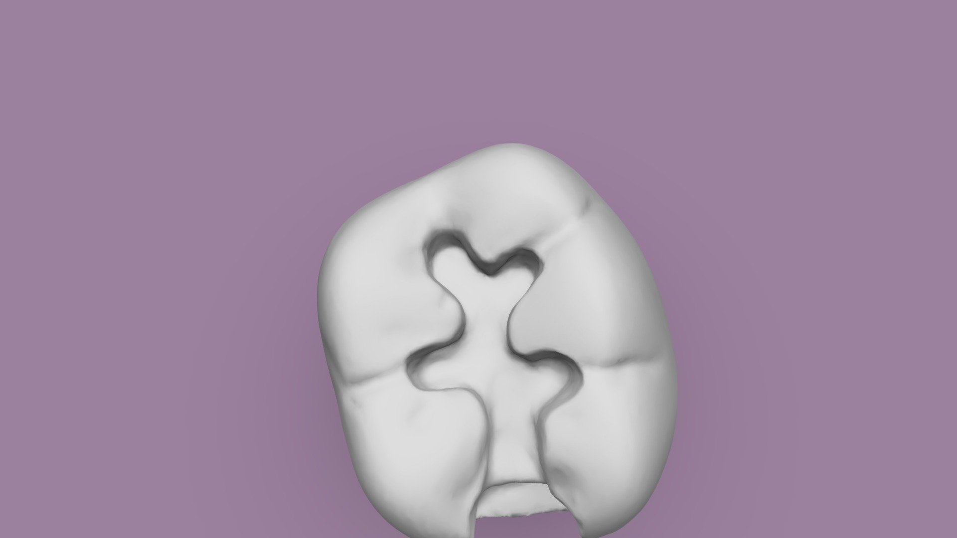 #19 MO Prep Example - 3D model by VCU - Restorative Dentistry (@sodgp ...