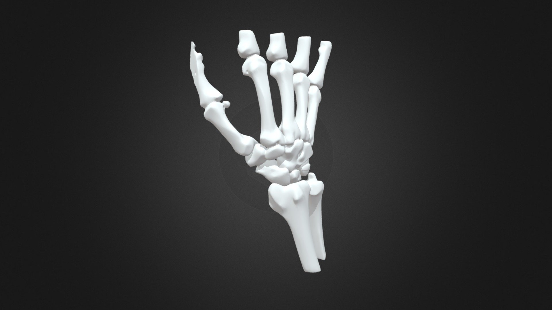 Triquetral Fracture - 3D model by yuhuihuang [a6eed62] - Sketchfab