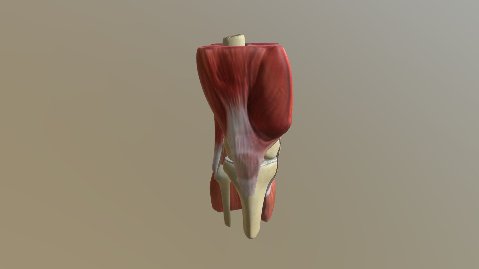 ACL Tear - 3D model by mckenzie.burch [a740097] - Sketchfab