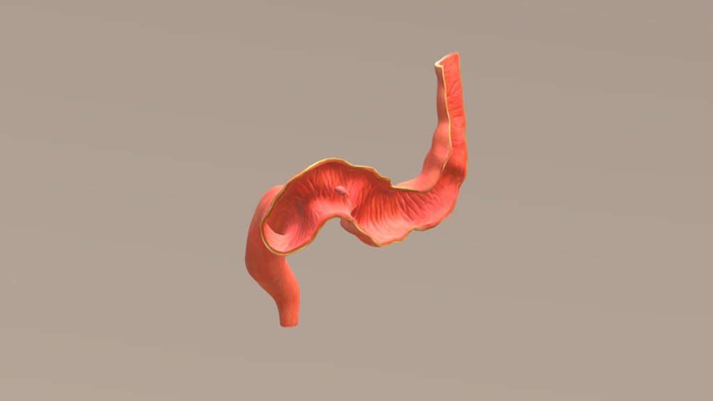 Sigmoid Colon Polyp - 3D model by sunnyboy2002 [a7ef2f2] - Sketchfab