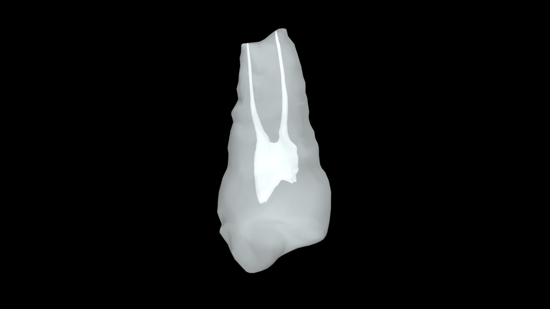Tooth 5-B - 3D model by biomed3d [a7f9876] - Sketchfab
