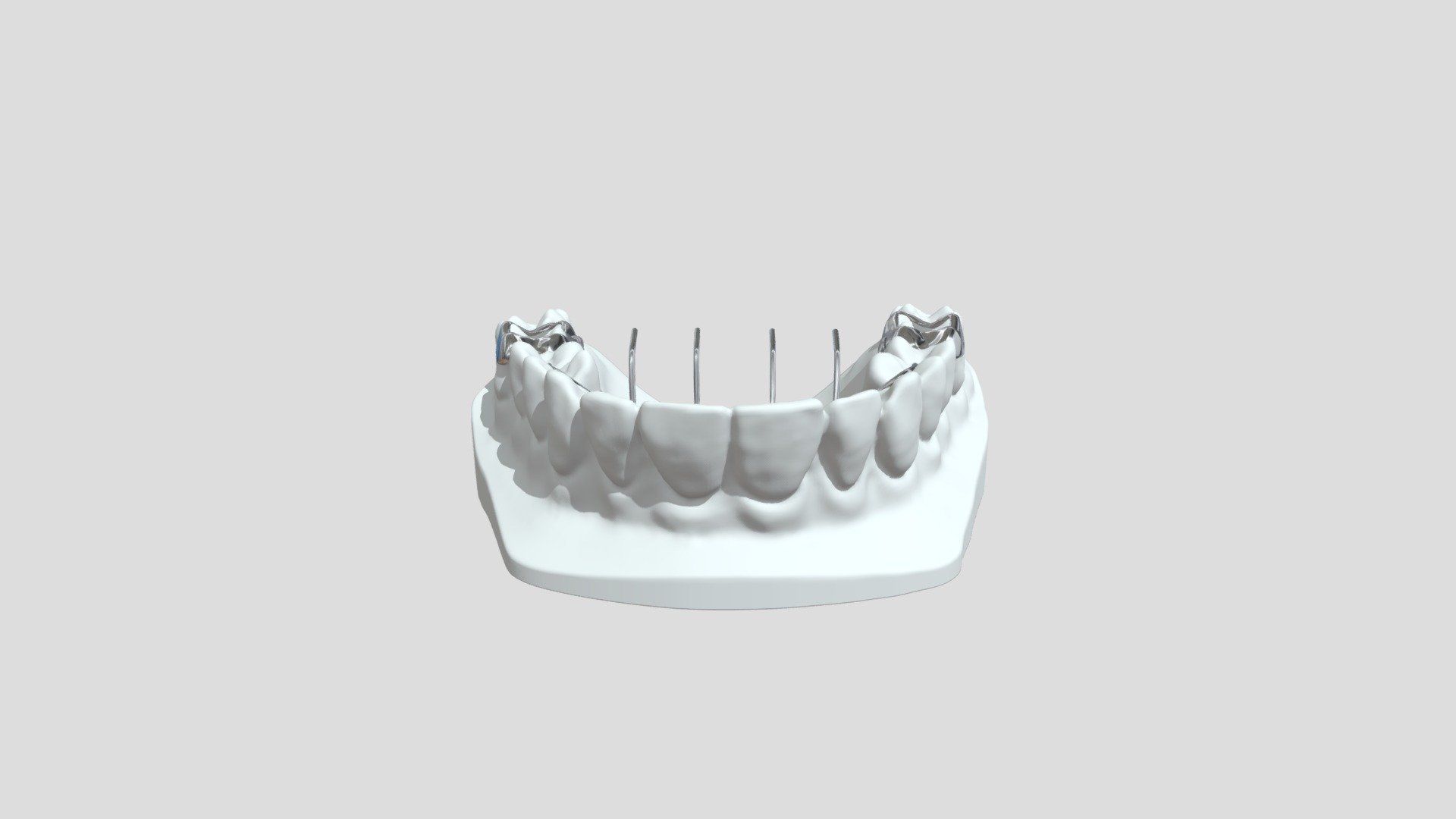 Rake Appliance - 3D model by ODL OrthoLab (@Odlortho) [a8d8907] - Sketchfab