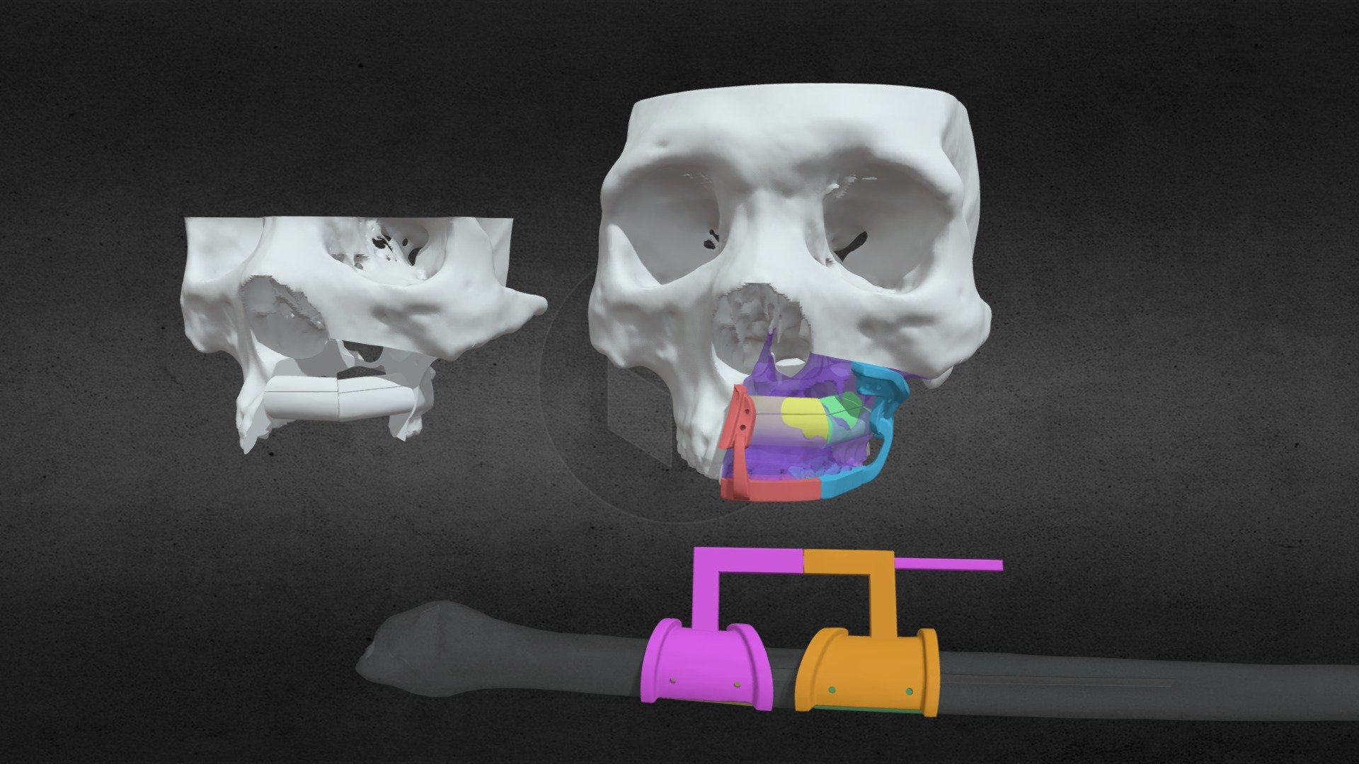 CSH DR.Chen-0716 - 3D model by vivian.detekt [a8f1f68] - Sketchfab