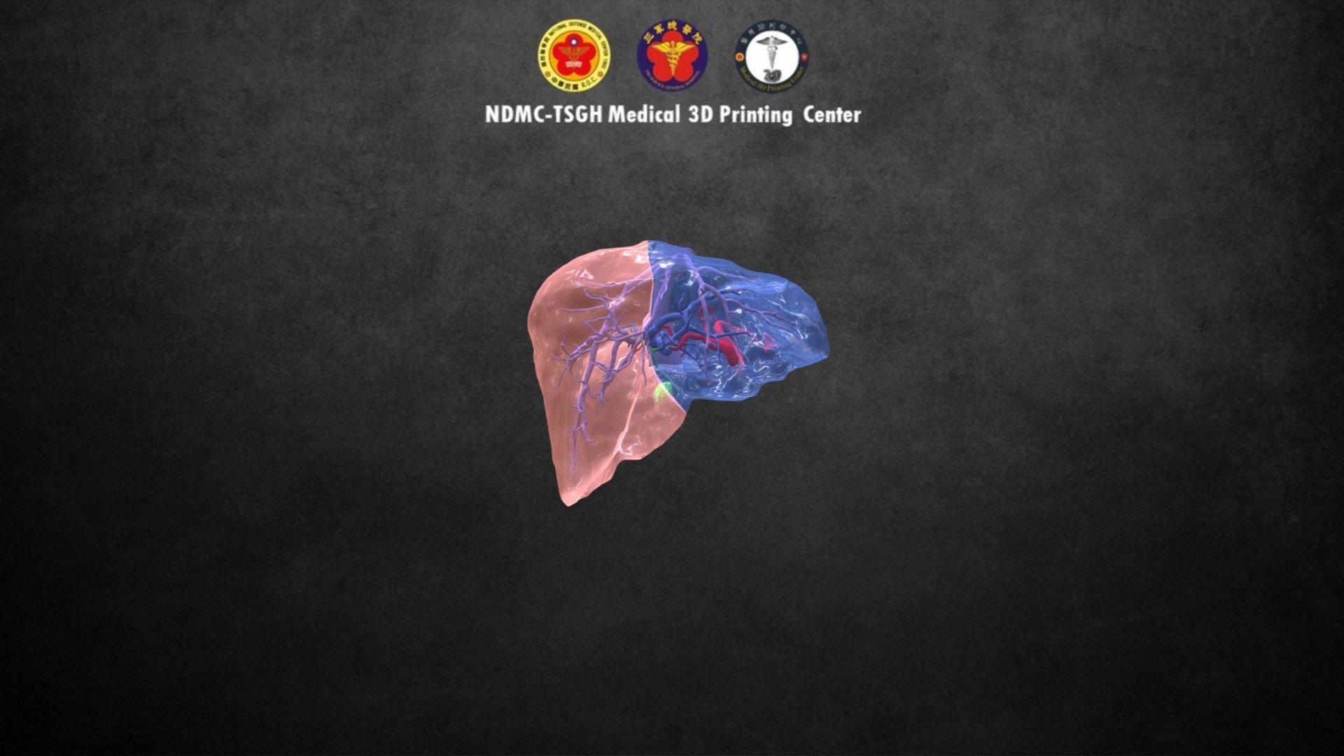 Liver-cut - Download Free 3D model by FablabNDMC [aa0c2aa] - Sketchfab