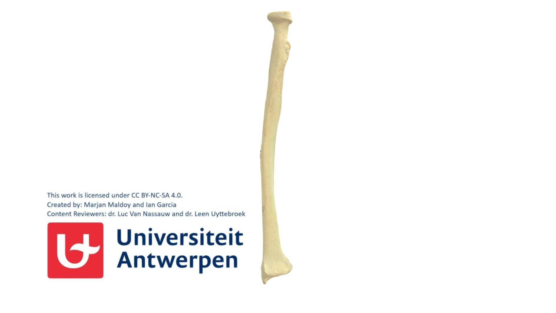 Radius R - Diafyse - 3D model by Universiteit Antwerpen (@marjanmaldoy ...