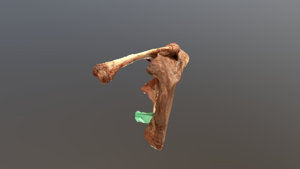 Upper Limb - A 3D model collection by raincity_bones - Sketchfab