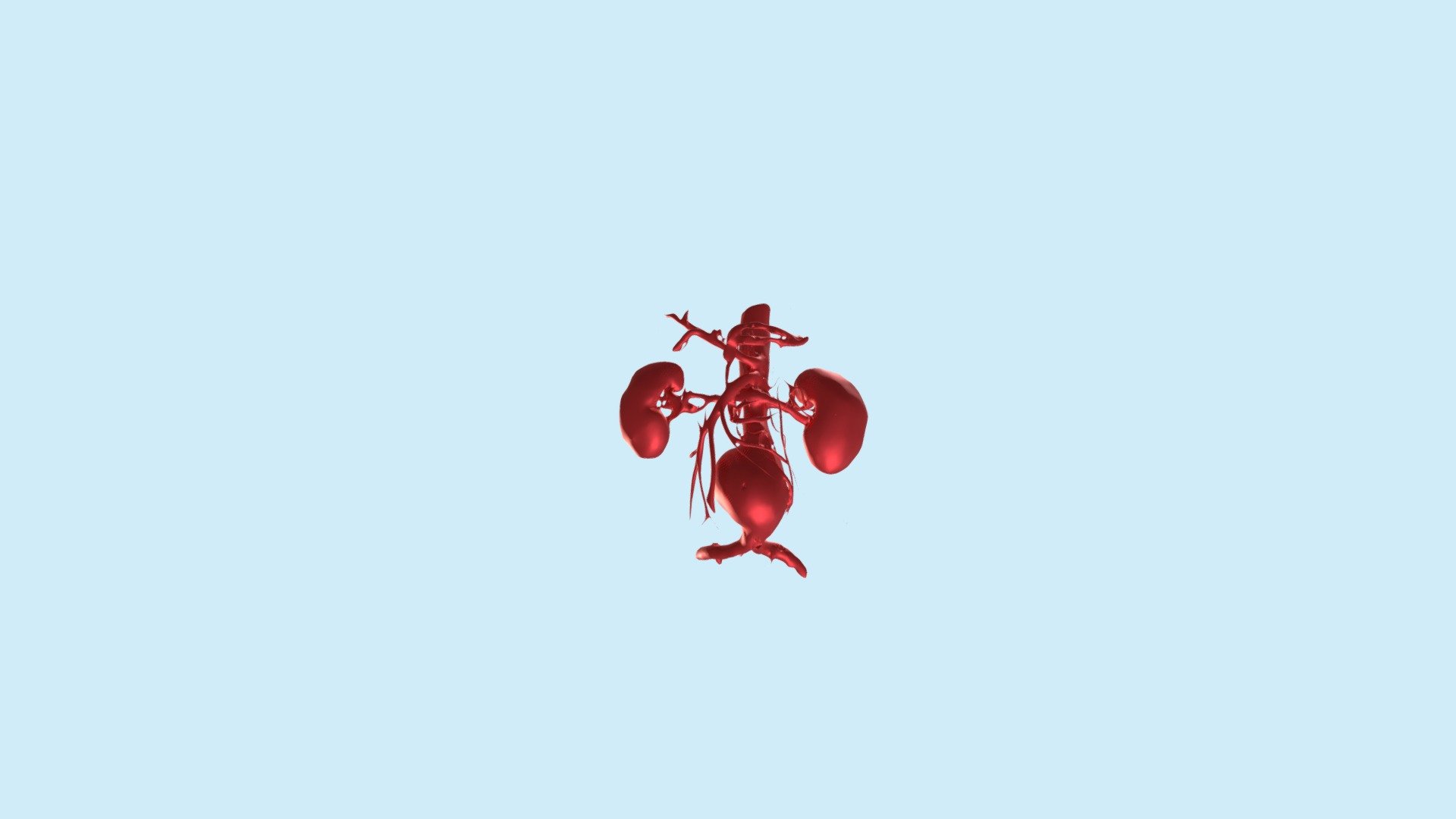 Abdominal Aortic Aneurysm by Iman Moradi - 3D model by ImanMoradi ...