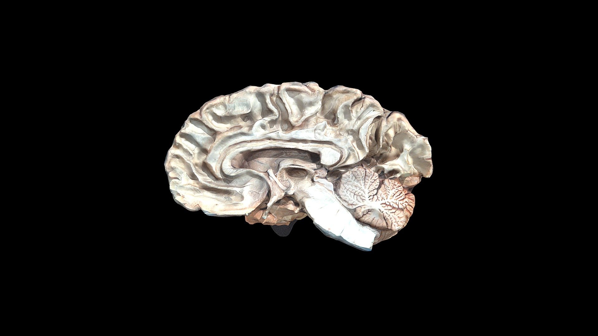Thalamic Fasciculus - 3D model by Istanbul-Microneurosurgery ...