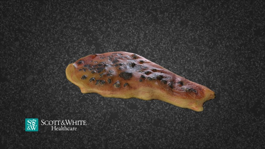 Gallbladder 76805 - 3D model by Scott & White Moulage Project ...