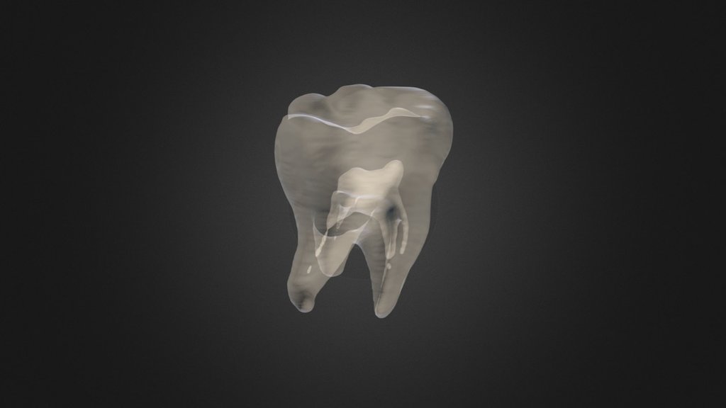 Tooth2 - 3D model by 3DPMRC [ab97cd0] - Sketchfab