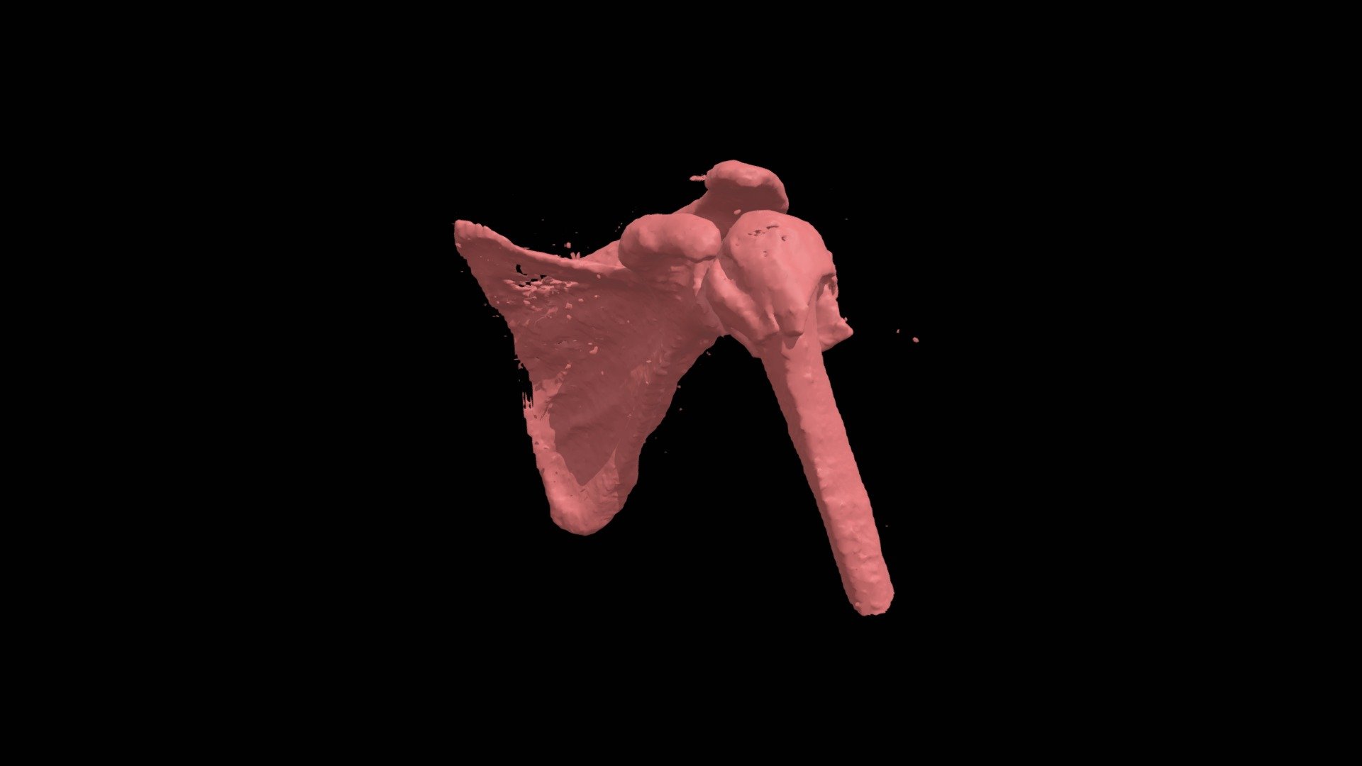 vishal desai - 3D model by Medimax Advance Radio-Imaging ...