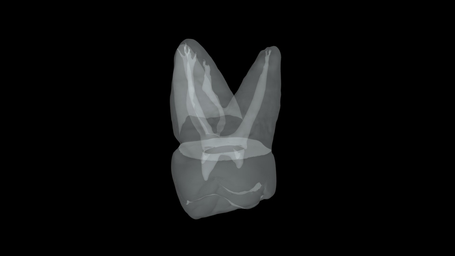 Tooth 3 - 3D model by biomed3d [ac65cf4] - Sketchfab