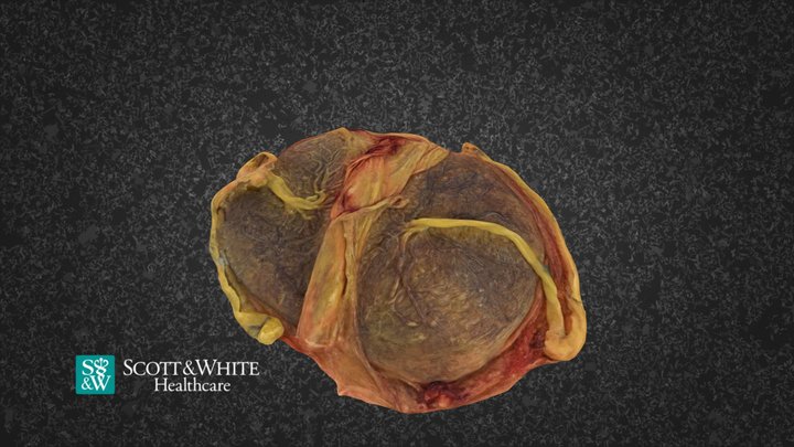 Placenta 3D models - Sketchfab