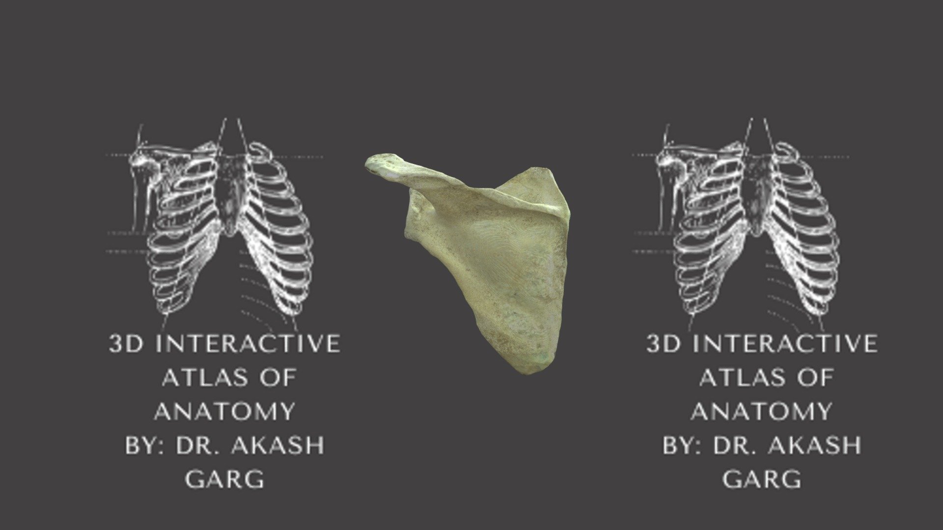 Left-scapula - 3D model by Akash.Garg1 [acb35c7] - Sketchfab