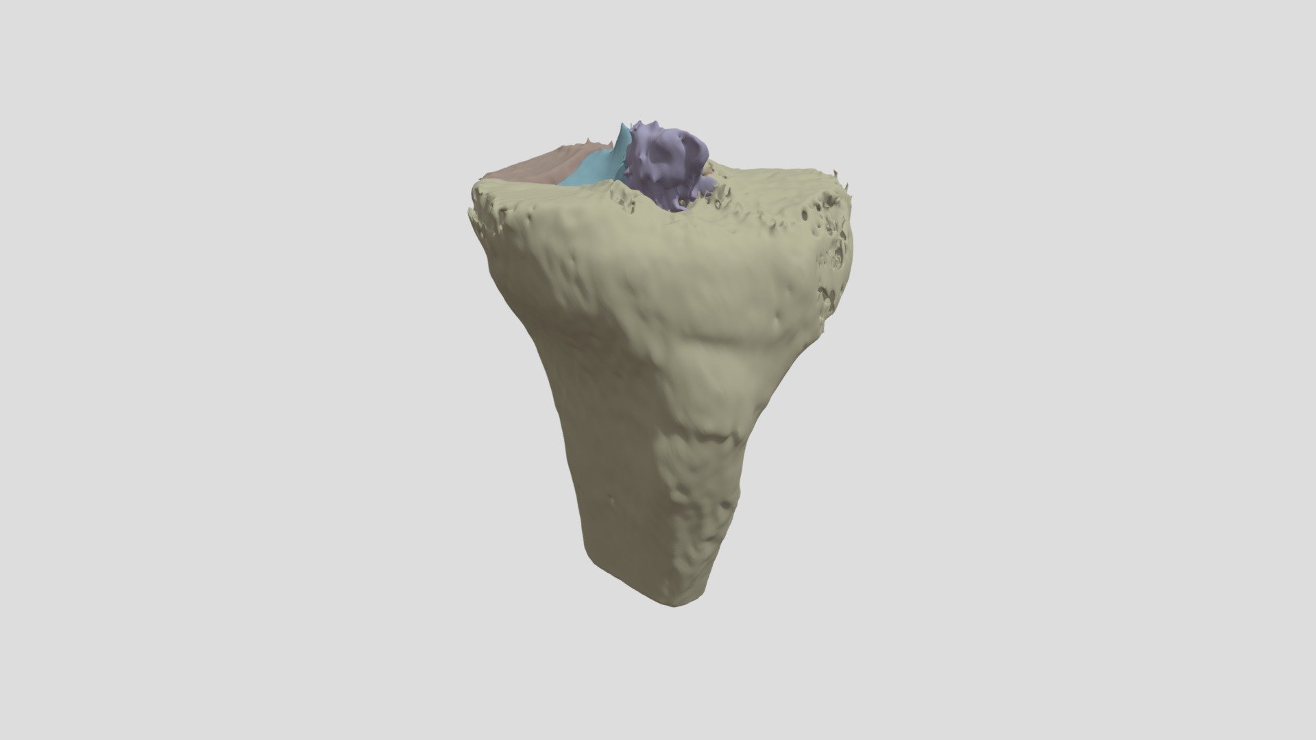 Cuzz Tibial Plateau - 3D model by fusi [ad252e9] - Sketchfab