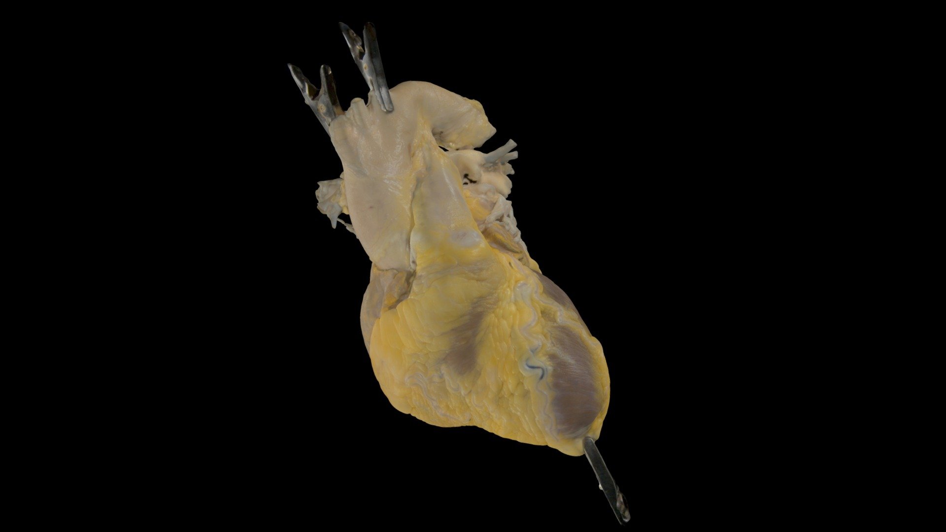 Fixed Human Heart Tricuspid Valve - Download Free 3D model by ...