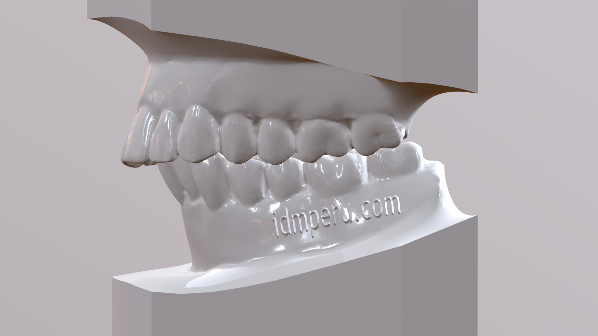 Oclusion Clase II-1 - Download Free 3D model by Idmperu [ad6cfc9 ...