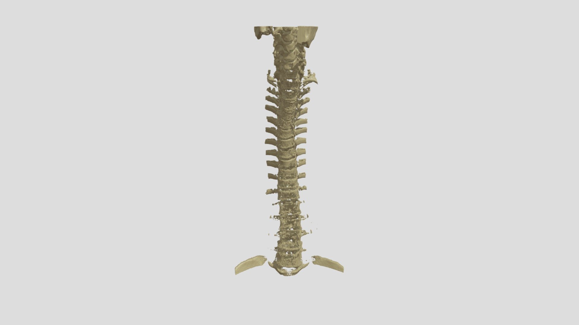My-Spine - 3D model by louisiaaron [ad93f1c] - Sketchfab