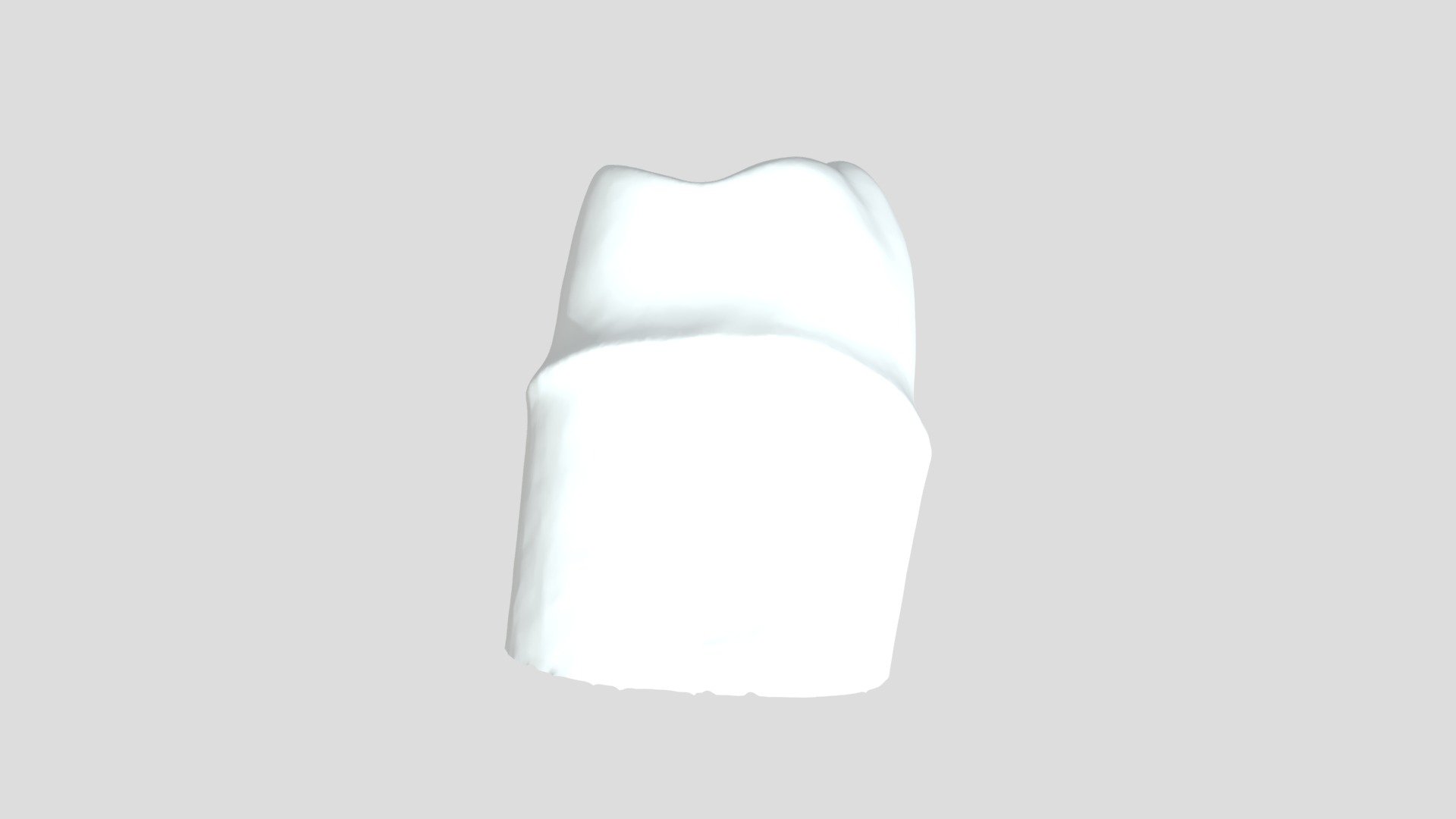 #30 Yellow Tooth Prep - 3D model by jedmond [adaba53] - Sketchfab