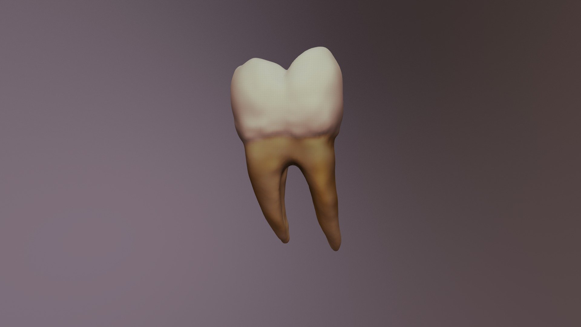 Molar 1 - 3D model by DH-ILUSTRATION (@danielrodrigo95) [adde150 ...