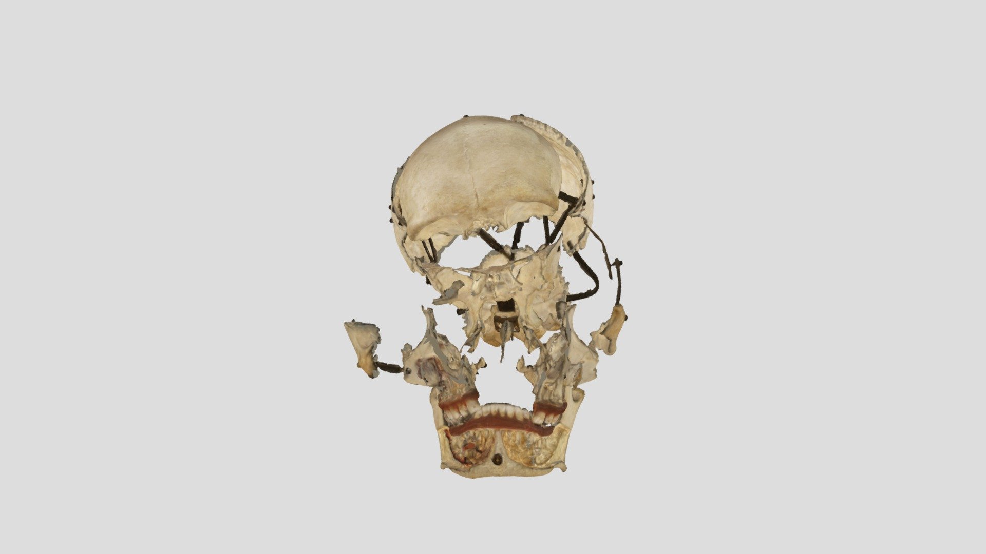 Exploded Skull Model - 3D model by m3dicube (@camm3dicube) [ae865b0 ...