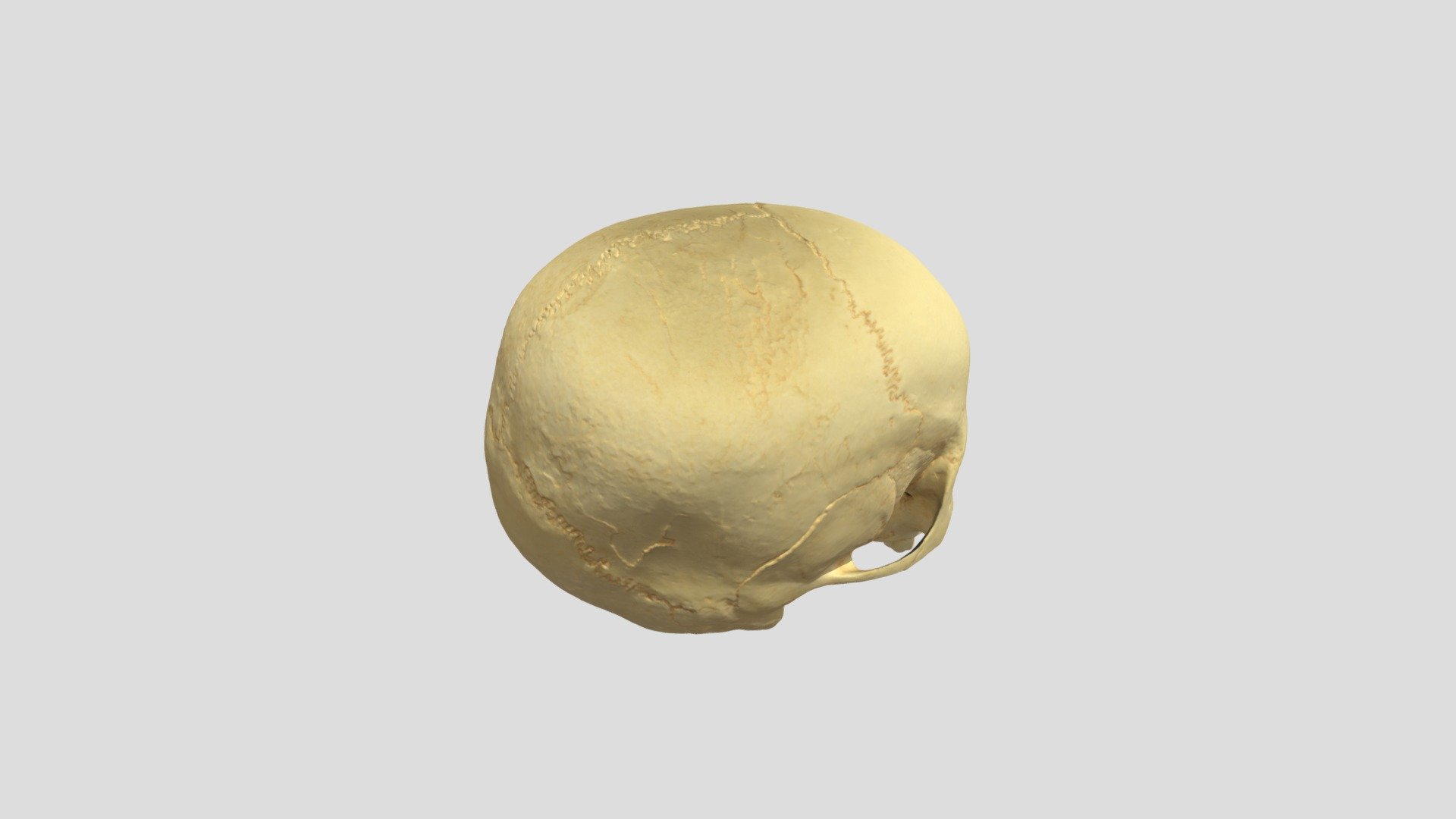 Cranium Cast - damaged - 3D model by alexbvail [af132ca] - Sketchfab