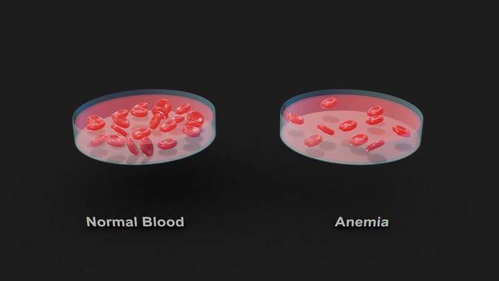 Anemiainfo 3D models - Sketchfab
