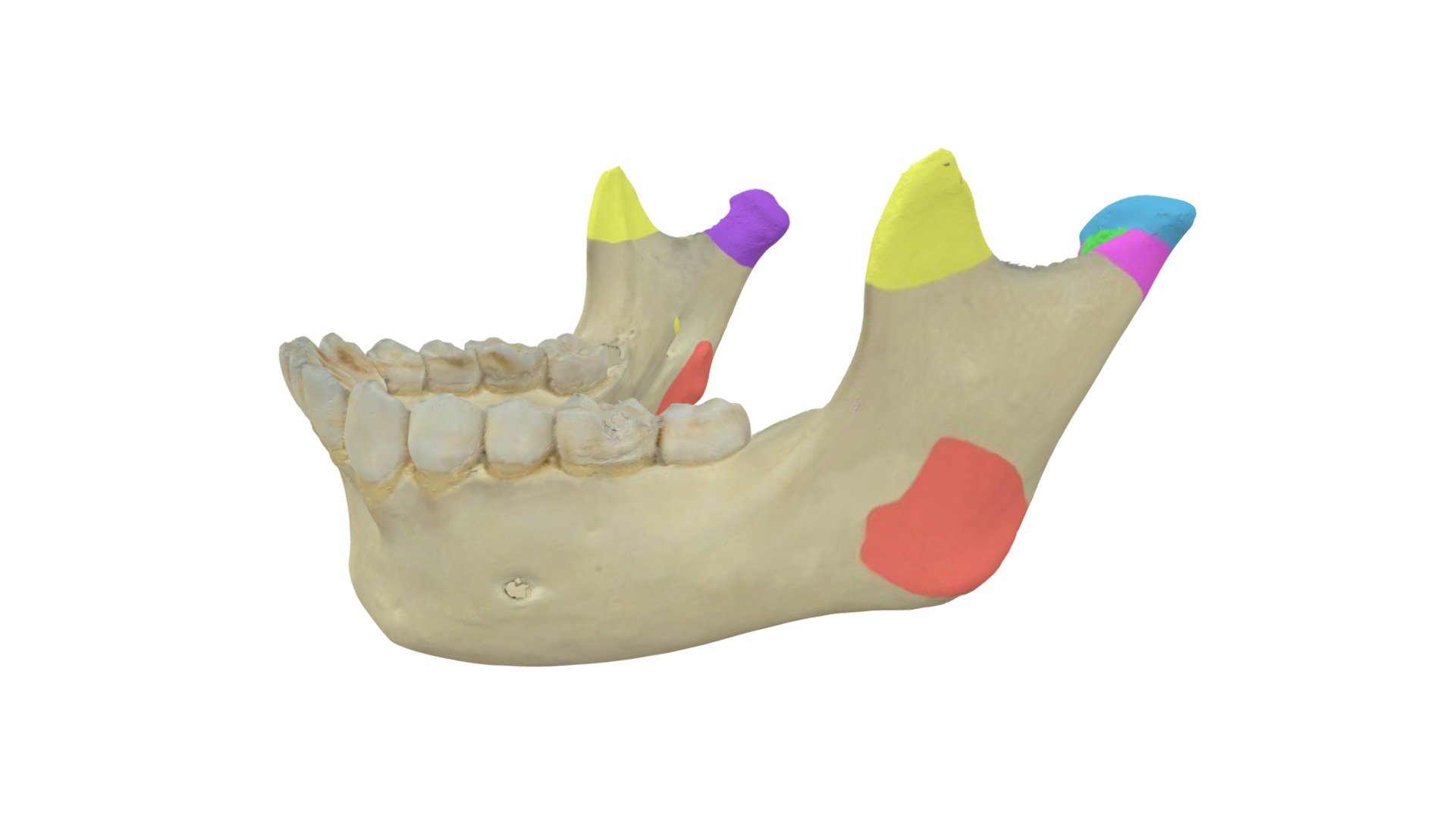 mandibula- ramus mandibulae - 3D model by Universiteit Antwerpen ...