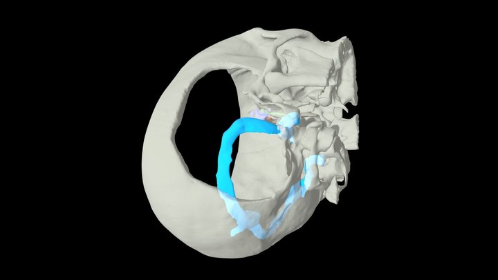 Posterior-fossa 3D models - Sketchfab