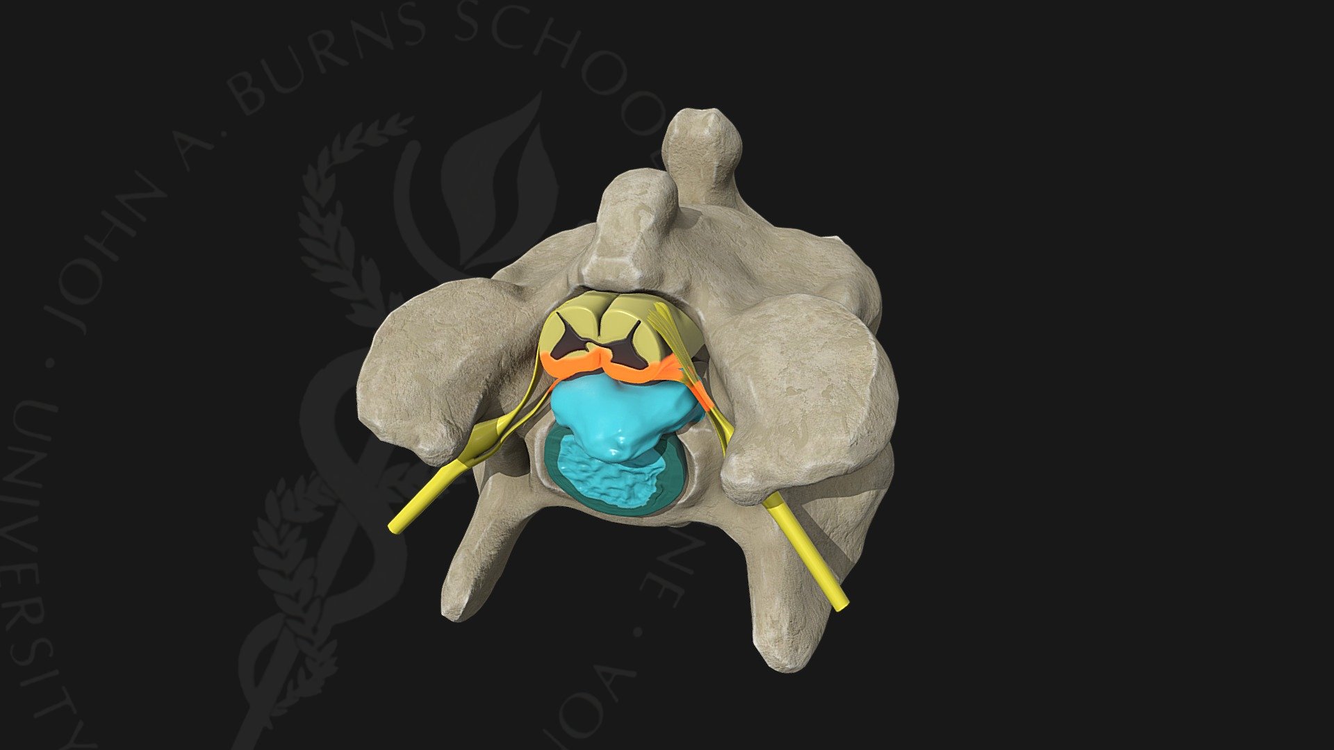 USP - CASE 1 (1) updated - 3D model by John A Burns School of Medicine ...