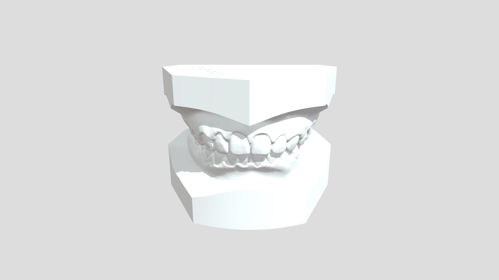 Case 4. Deep overbite B model JH Kwon - 3D model by orthogiant [b1c6f13 ...
