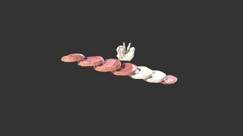 Prostate (sectioned) - 3D model by Christopher M. Smith, CMI (@csmith11 ...