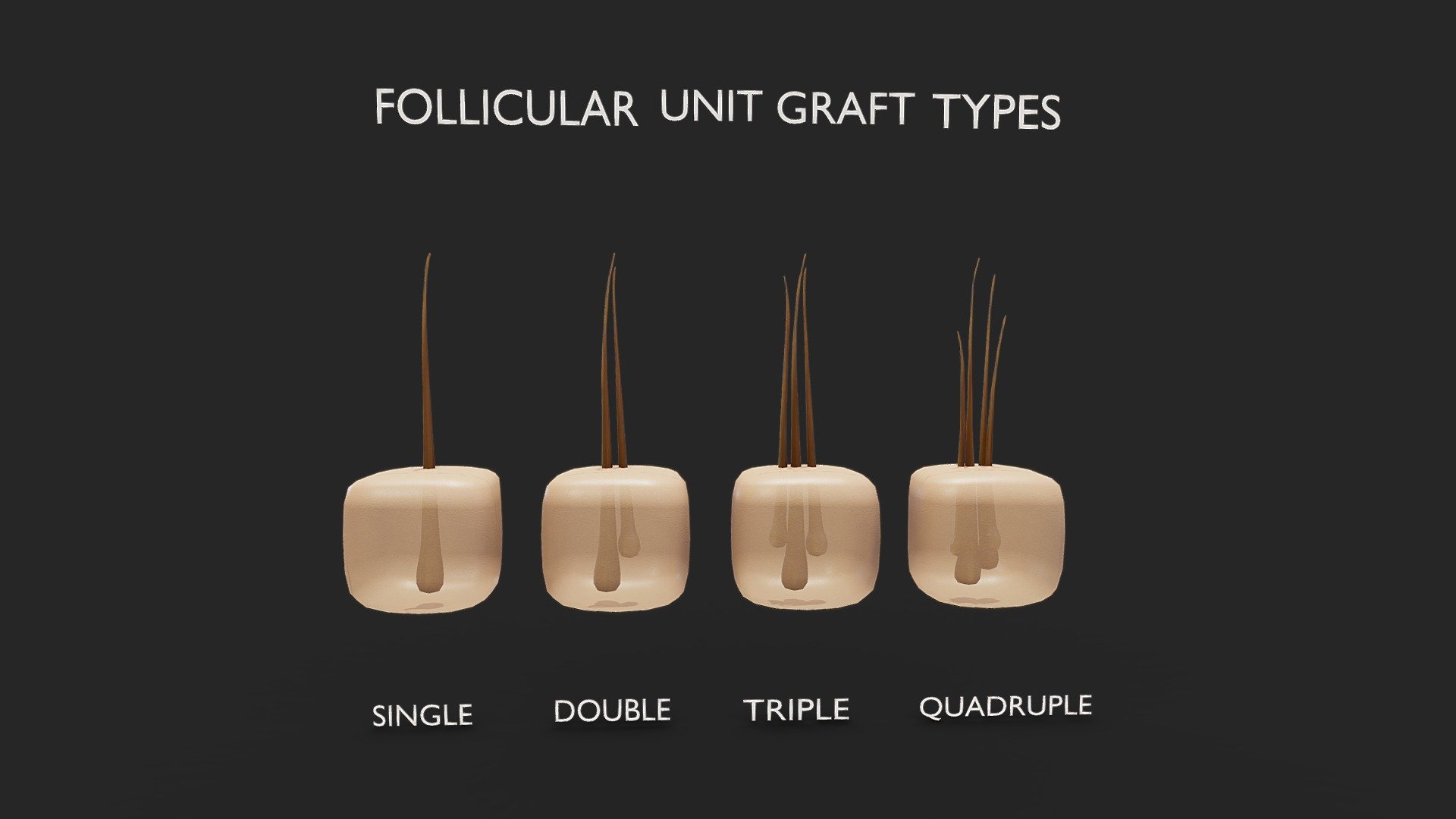 Follicular Unit Graft Types - Buy Royalty Free 3D model by Nima ...