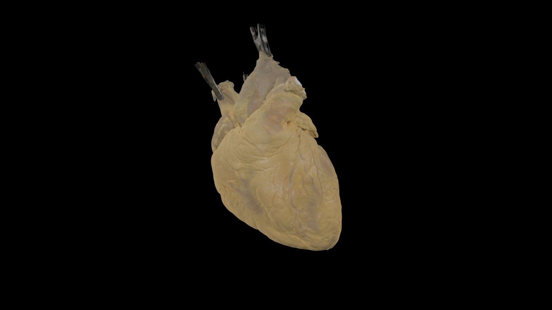 Fixed Human heart #0174 - Download Free 3D model by VisibleHeartLabs ...