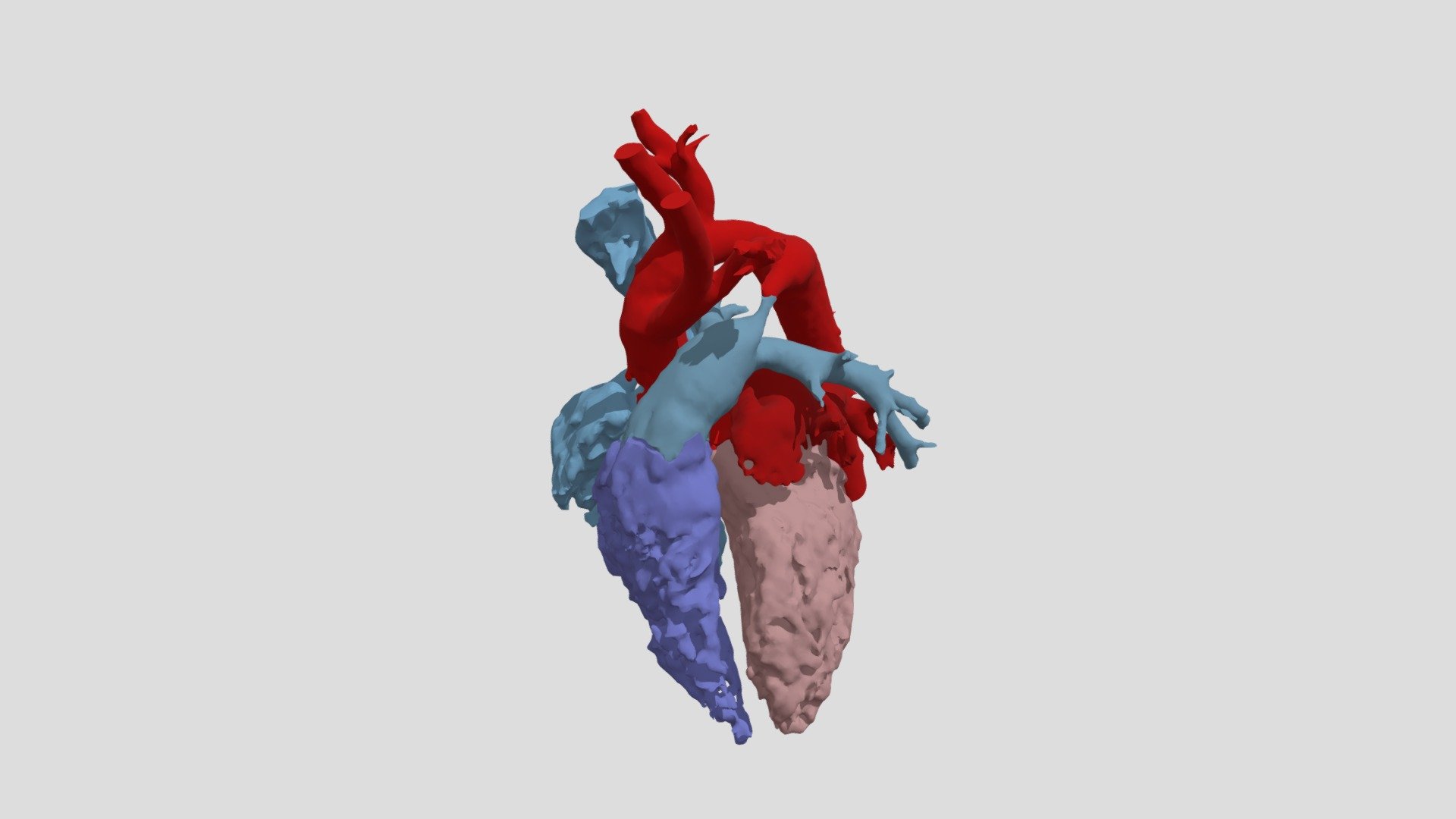Vascular Ring, Right Aortic Arch (S0296) - 3D model by NCHS Cardiac ...