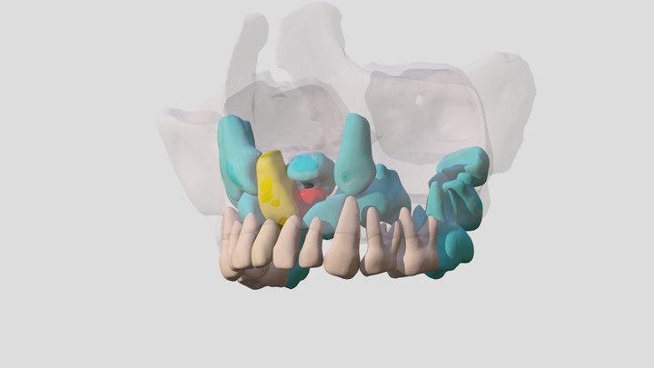 Orthodontics 3D models - Sketchfab