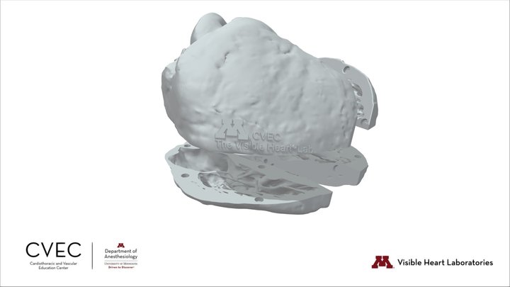 Echocardiography 3D models - Sketchfab