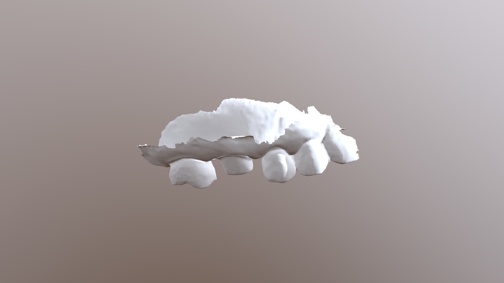 戴舒珊 Maxillary Anatomy - 3D model by suhu [b46c1be] - Sketchfab