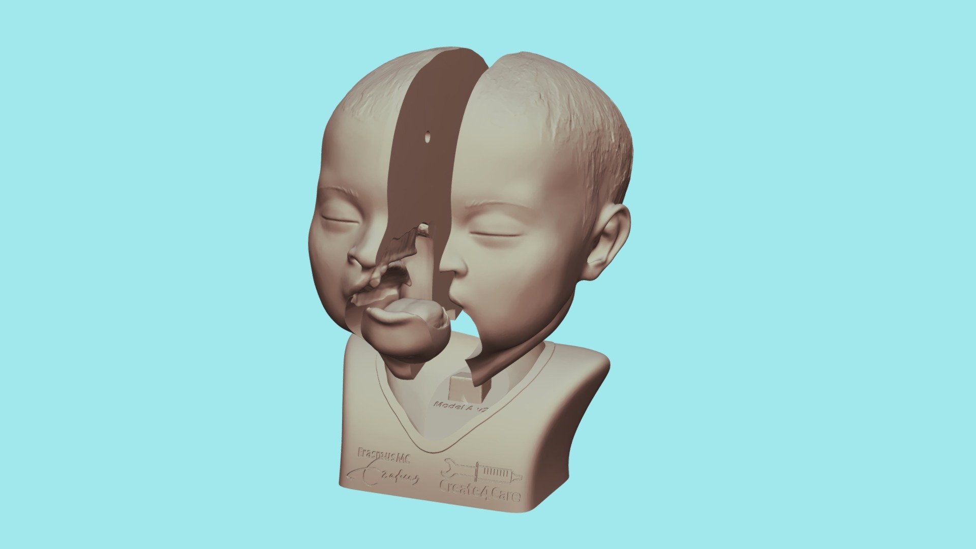 Cleft lip and palate educational model A Toet - Download Free 3D model ...