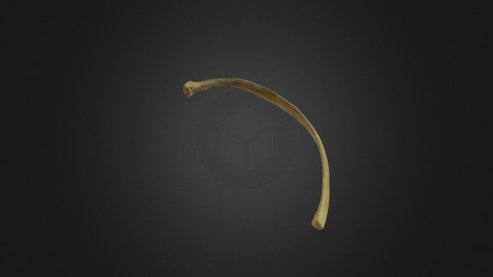 Tuberculosis 3D models - Sketchfab