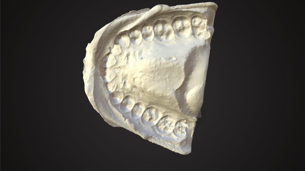 Dental cast - 3D model by 3dflow [b53b536] - Sketchfab